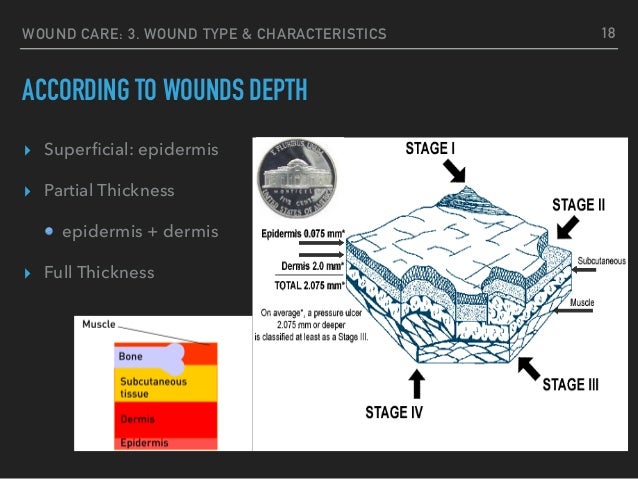 Wound care