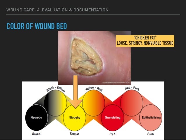 Wound care