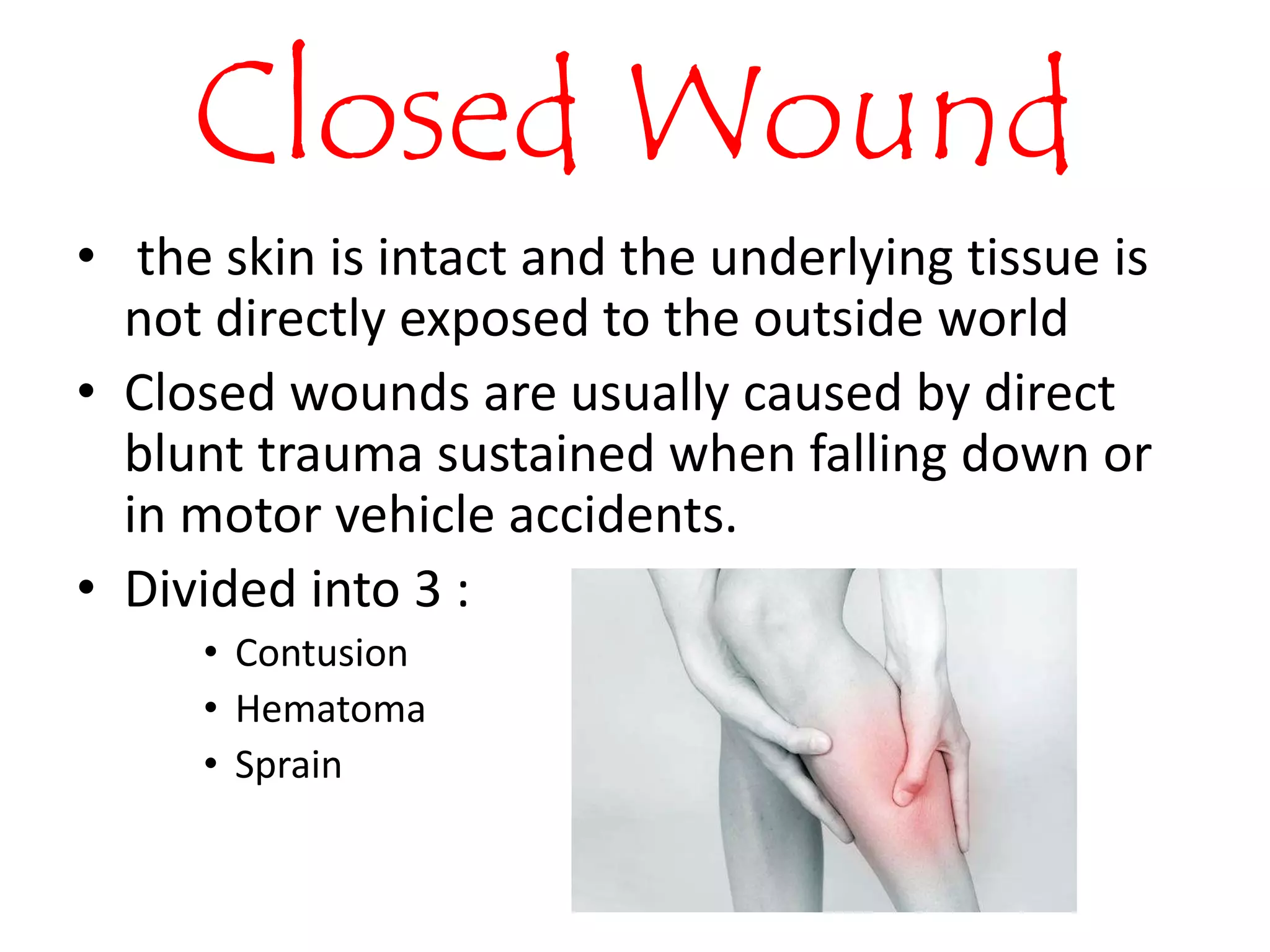 Wound care and treatment for nursing | PPTX