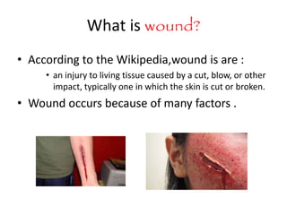 Wound care and treatment for nursing | PPTX