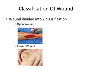 Wound care and treatment for nursing | PPTX