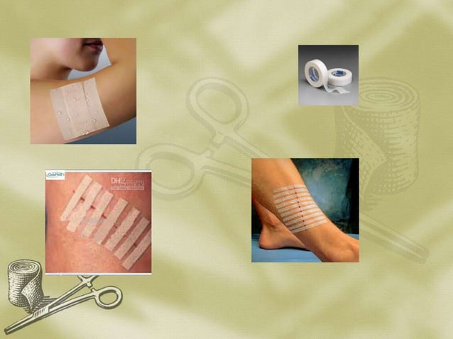 Wound care dressing and products | PPTX