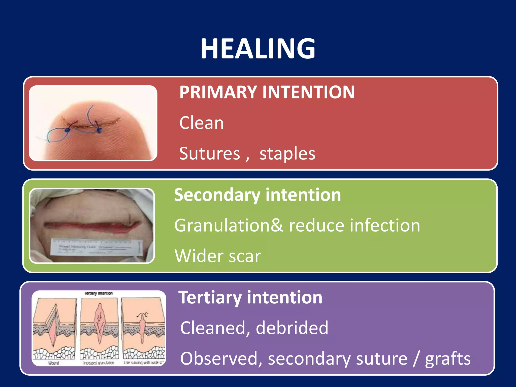 Wound care essentials | PPTX