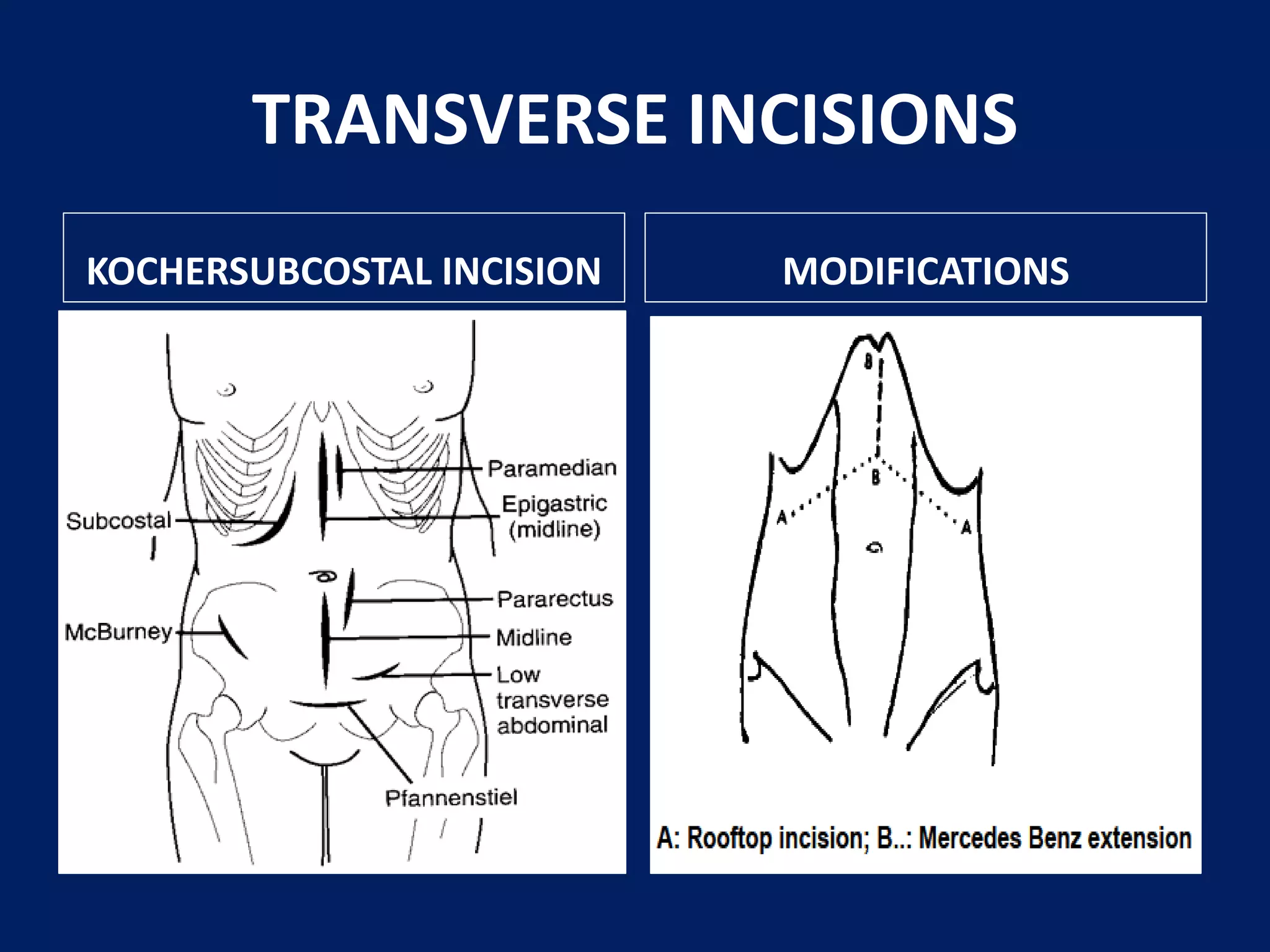 Wound care essentials | PPTX