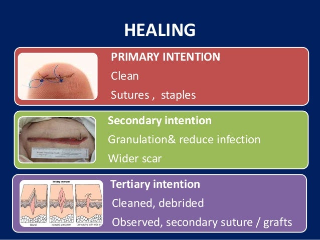 Wound care essentials