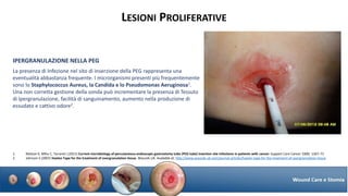 Wound care e stomia | PDF