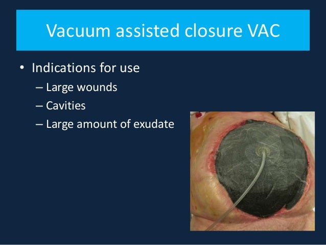 Wound care for nurses