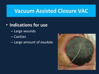 wound dressing for chronic wound | PPTX