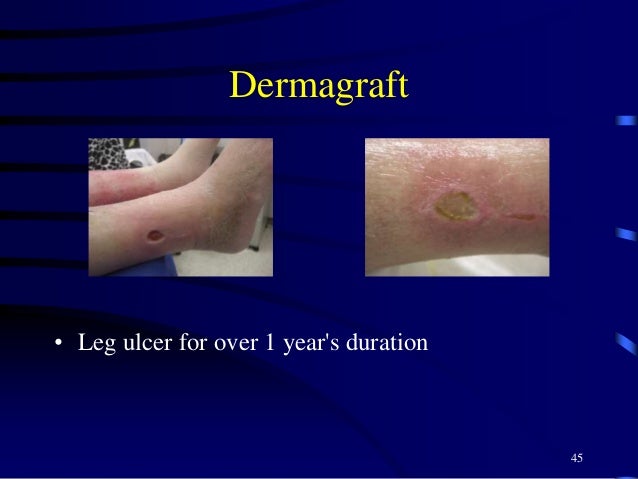2015: Wounds in the Geriatric Population-Salas