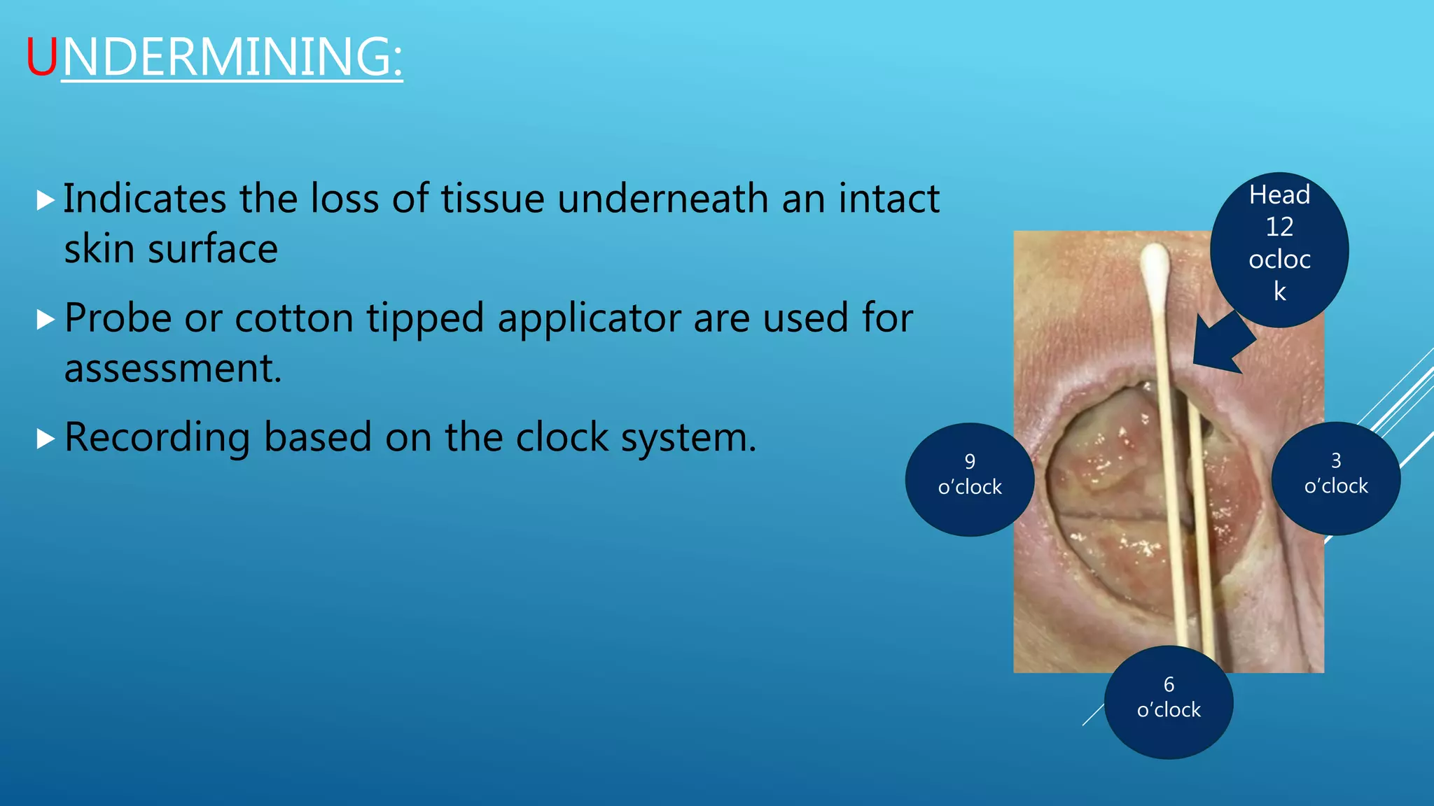 Wound care management | PPTX