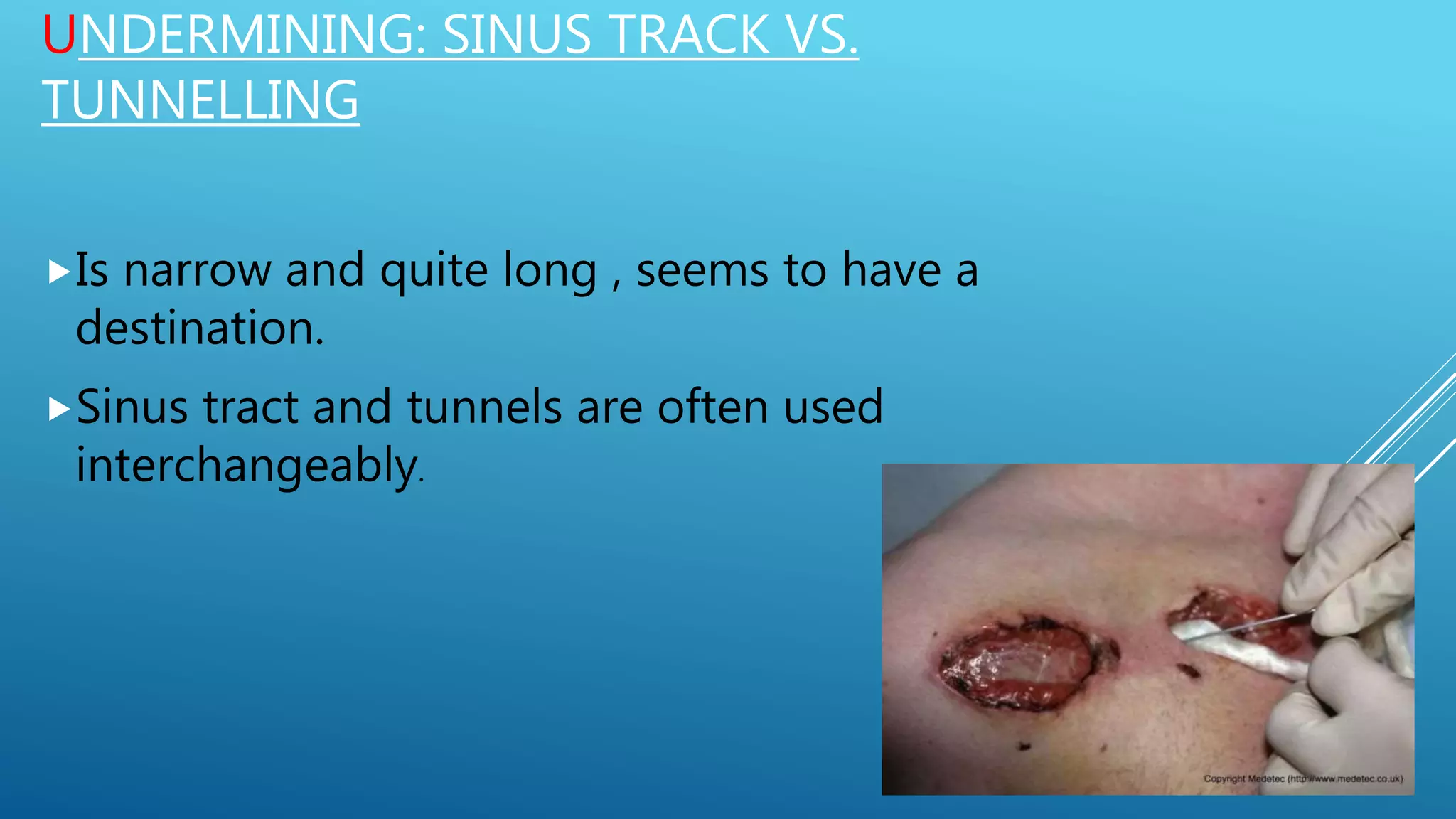 Wound care management | PPTX