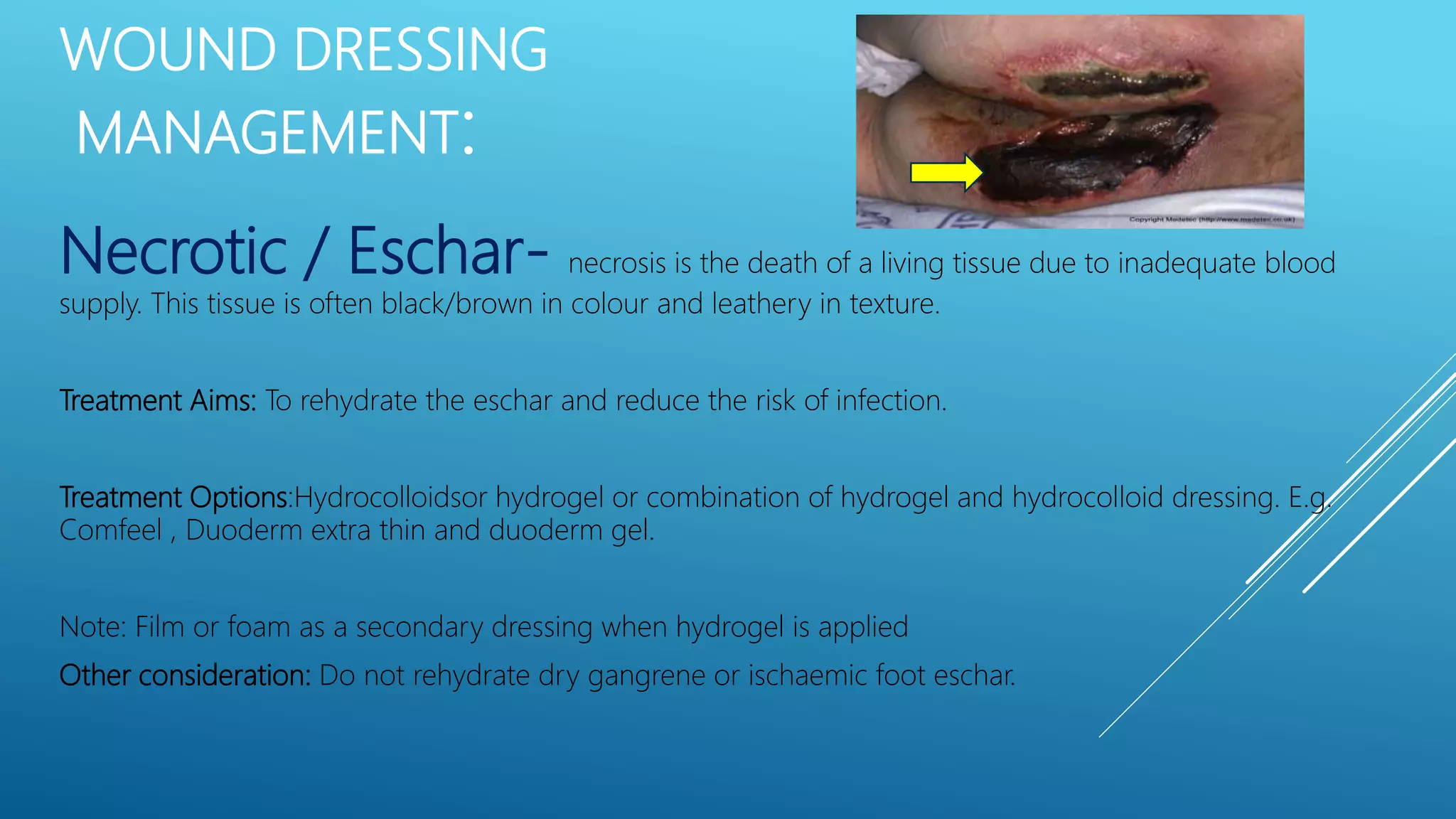 Wound care management | PPTX