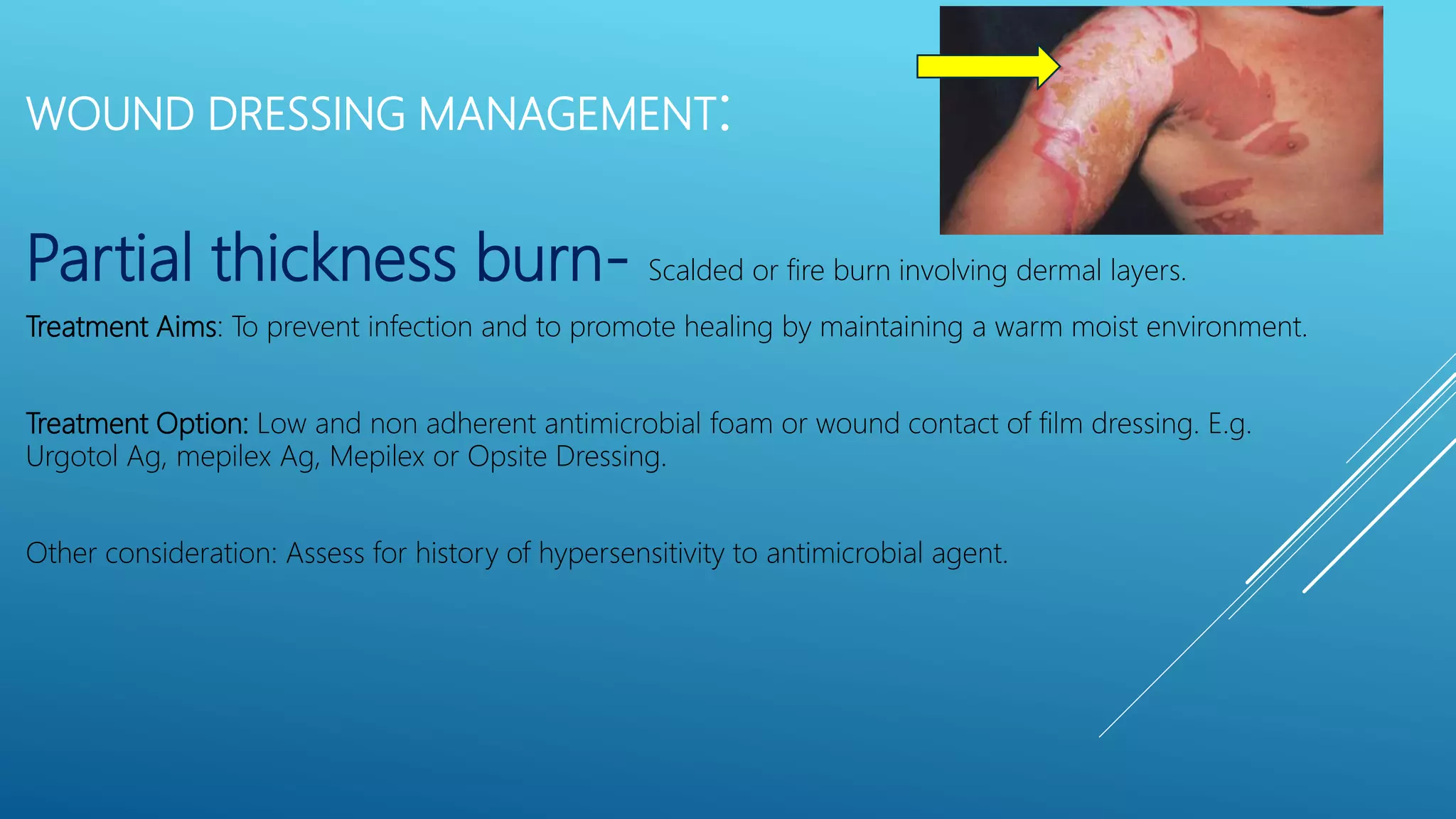 Wound care management | PPTX