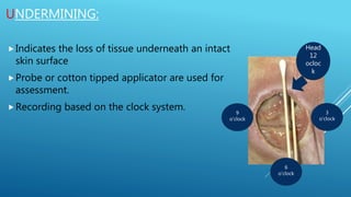 Wound care management | PPTX