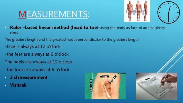 Wound care management
