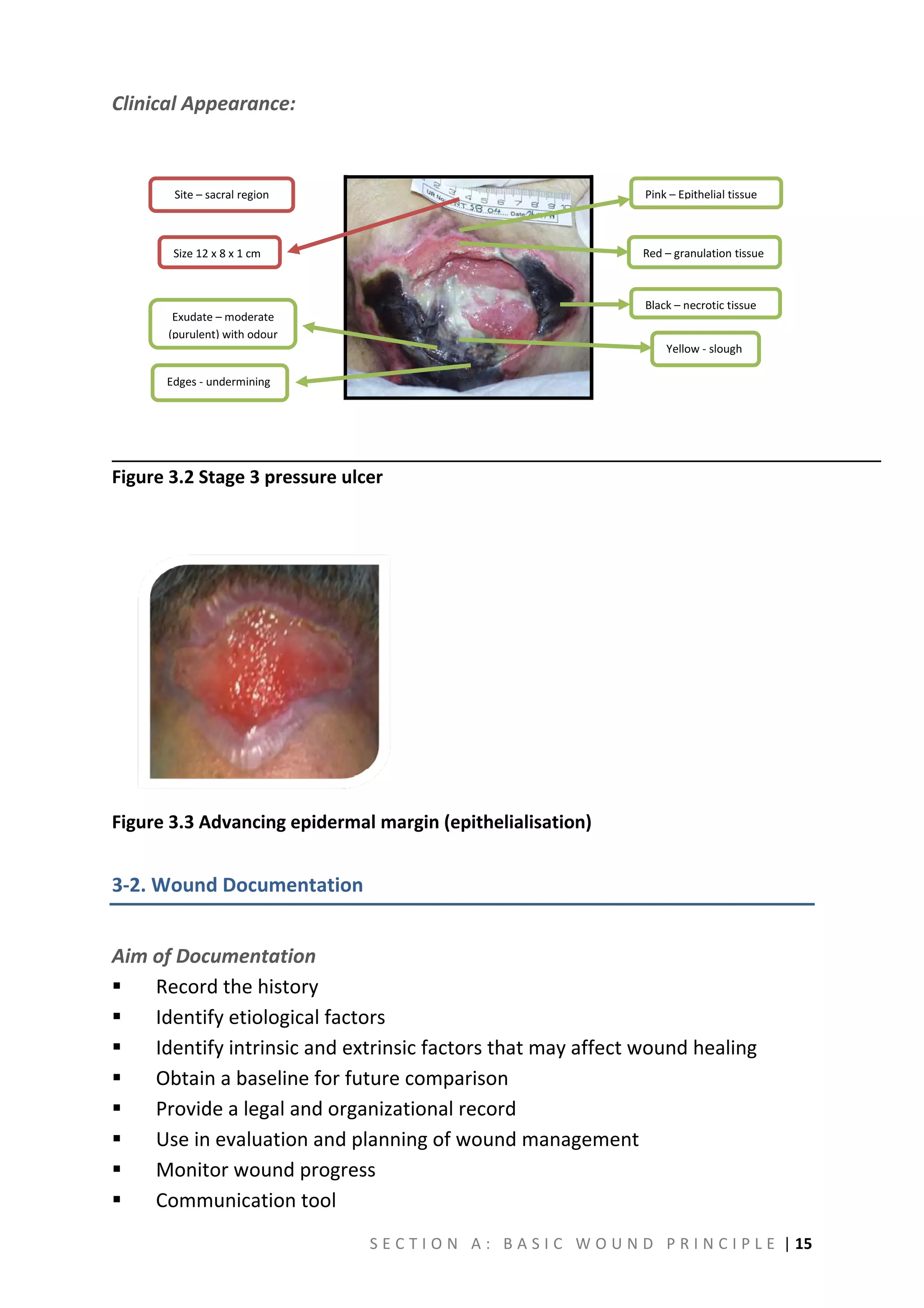 Wound Care Manual, 1st Edition 2014 | PDF