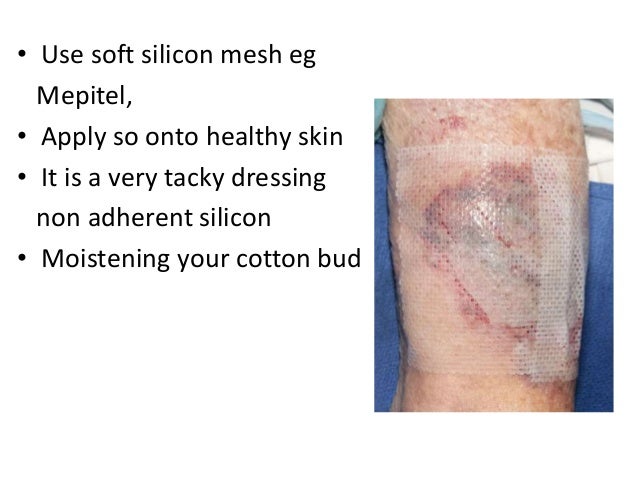 Wound Care SCGH
