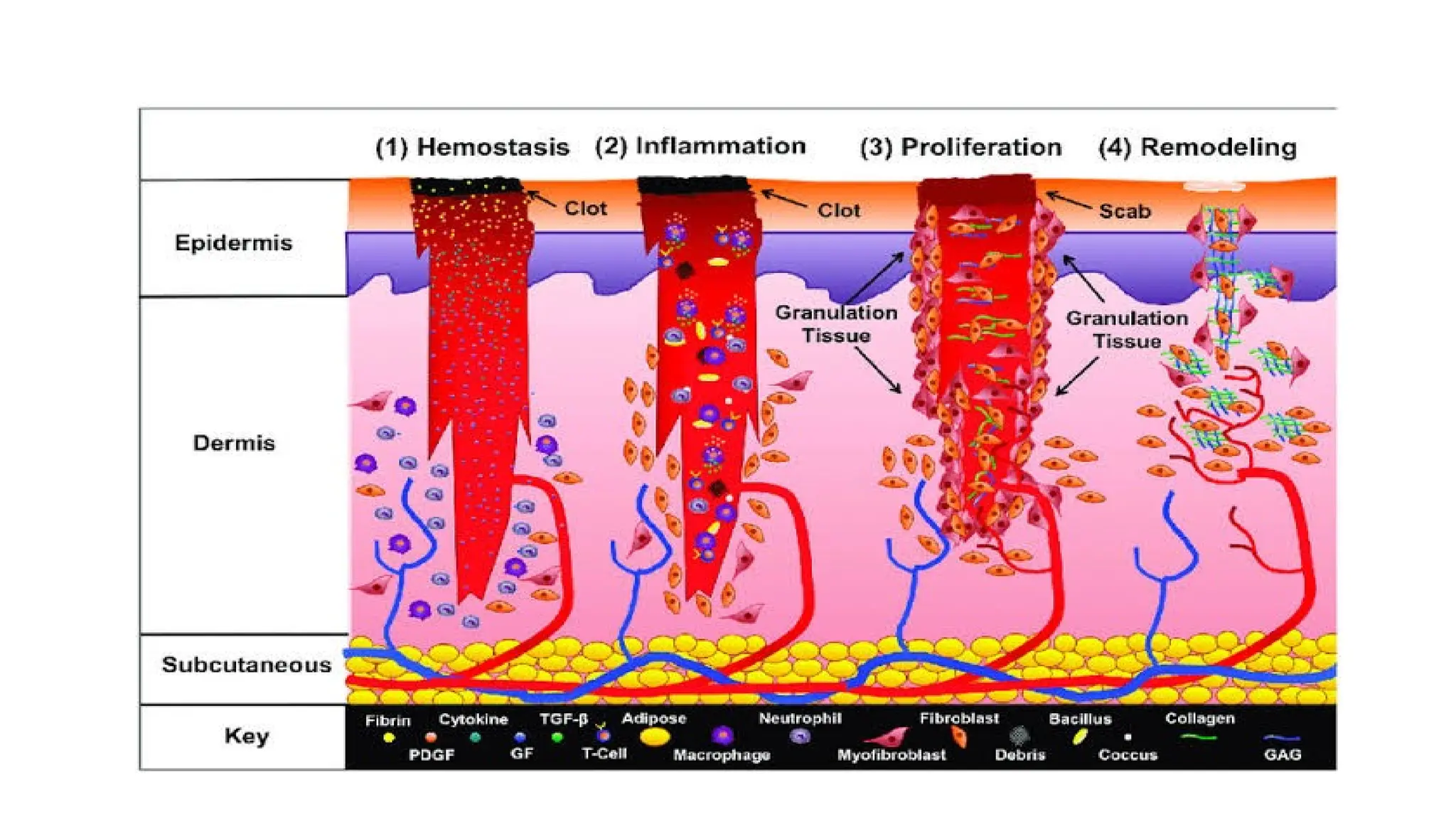 WOUND CLASSIFICATION AND MECHANISM OF WOUND REPAIR.pptx