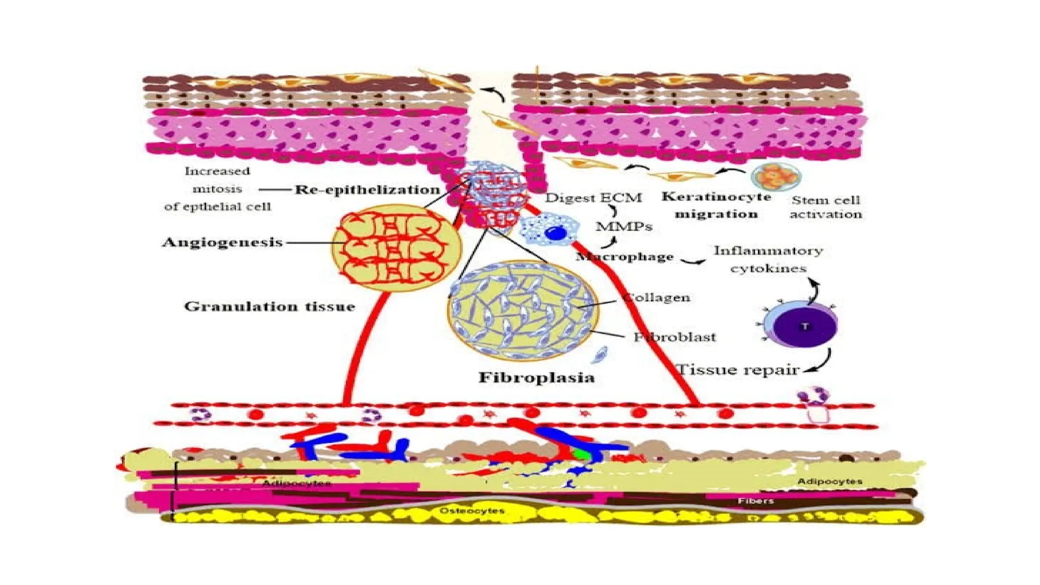 WOUND CLASSIFICATION AND MECHANISM OF WOUND REPAIR.pptx