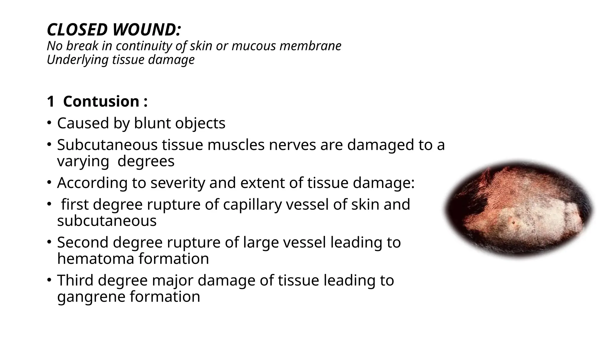 WOUND CLASSIFICATION AND MECHANISM OF WOUND REPAIR.pptx