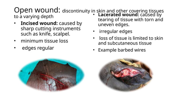 WOUND CLASSIFICATION AND MECHANISM OF WOUND REPAIR.pptx
