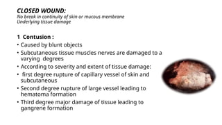 WOUND CLASSIFICATION AND MECHANISM OF WOUND REPAIR.pptx