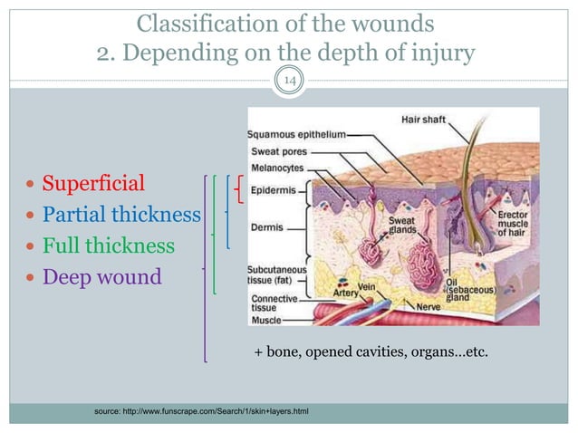 Wound Classifications.ppt