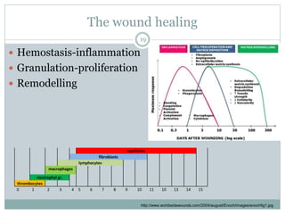 Wound Classifications.ppt
