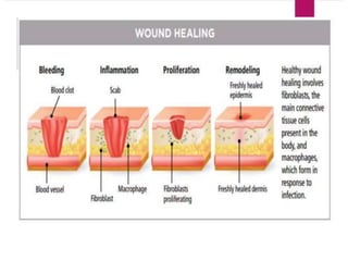 Wound Classifications.ppt