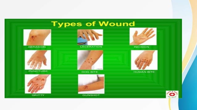 WOUND CLOSURE AND COMPLICATION | PPTX