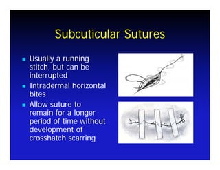 woundclosureknottying other things to use.pdf