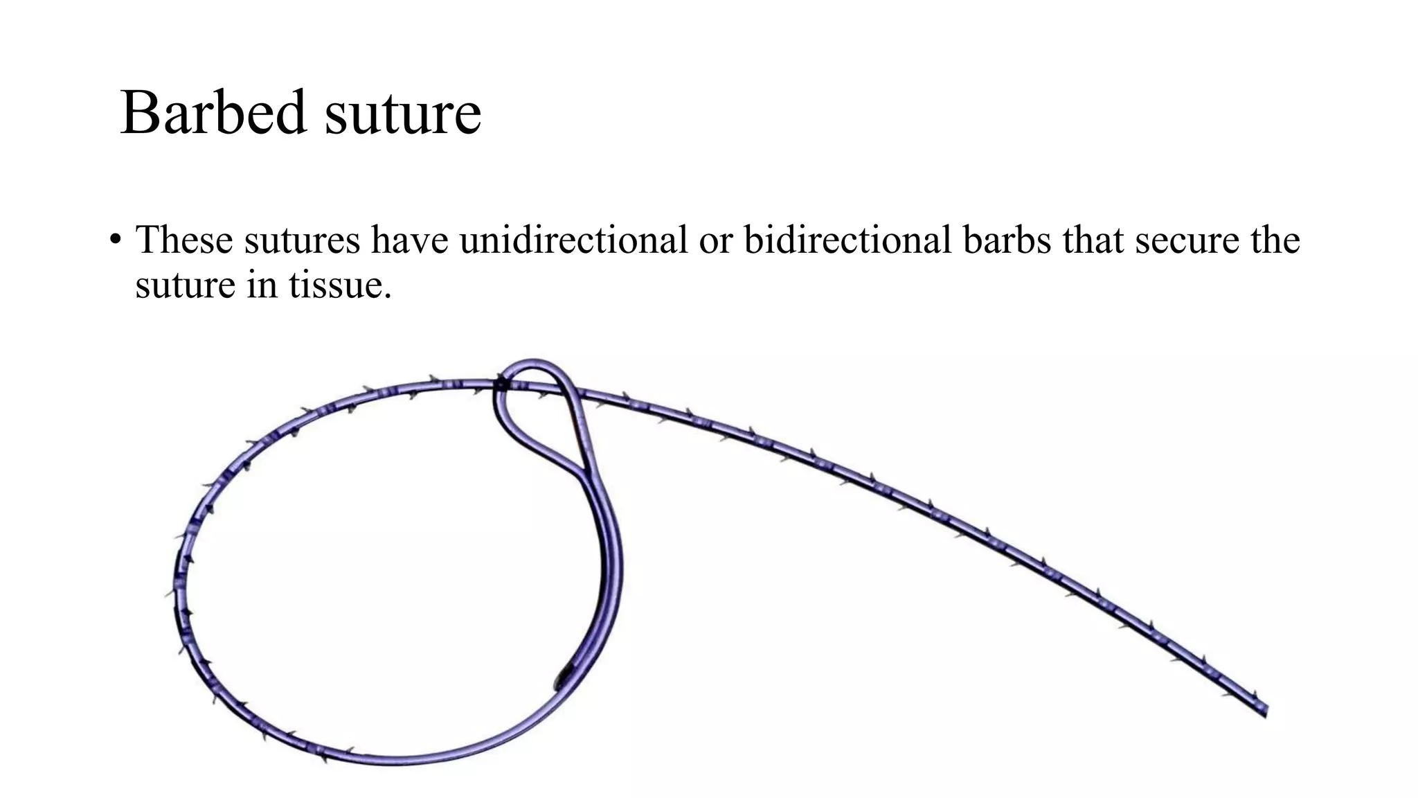 Wound closure, suture material, technique and alternative to suture | PPTX