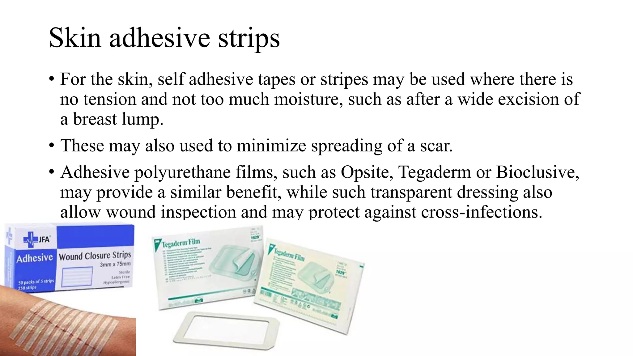 Wound closure, suture material, technique and alternative to suture | PPTX