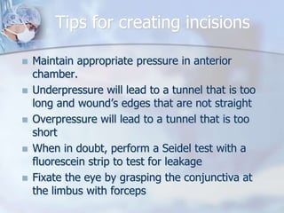 Wound construction For Cataract Surgery | PPTX