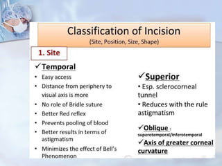Wound construction For Cataract Surgery | PPTX