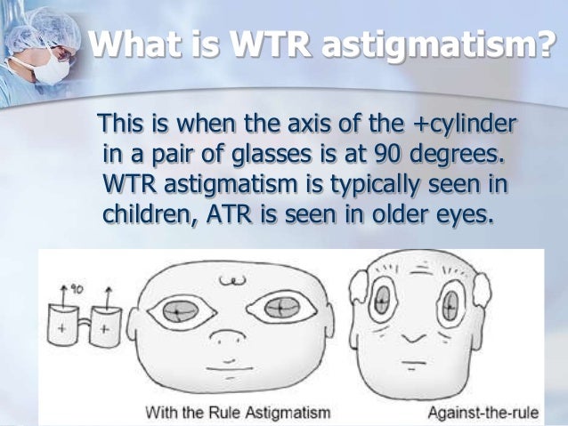 Wound construction For Cataract Surgery