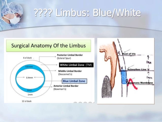 Wound construction For Cataract Surgery