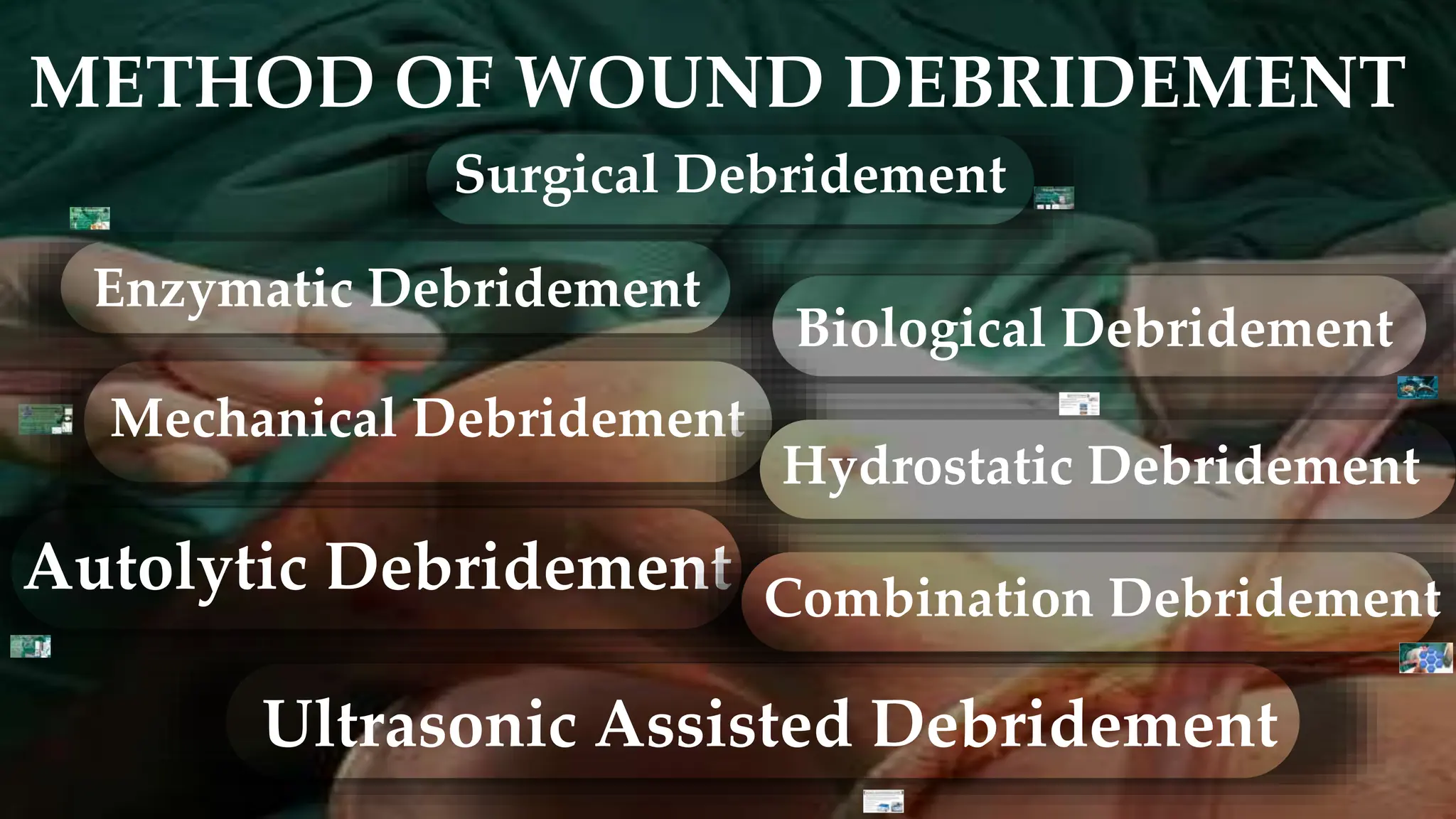 wound debriderment.pptx