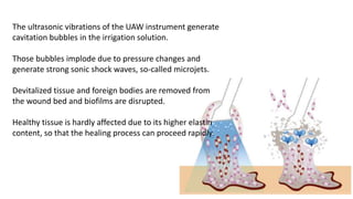 wound debriderment.pptx