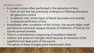 corneo scleral wound healing in sics | PPTX