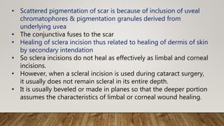 corneo scleral wound healing in sics | PPTX