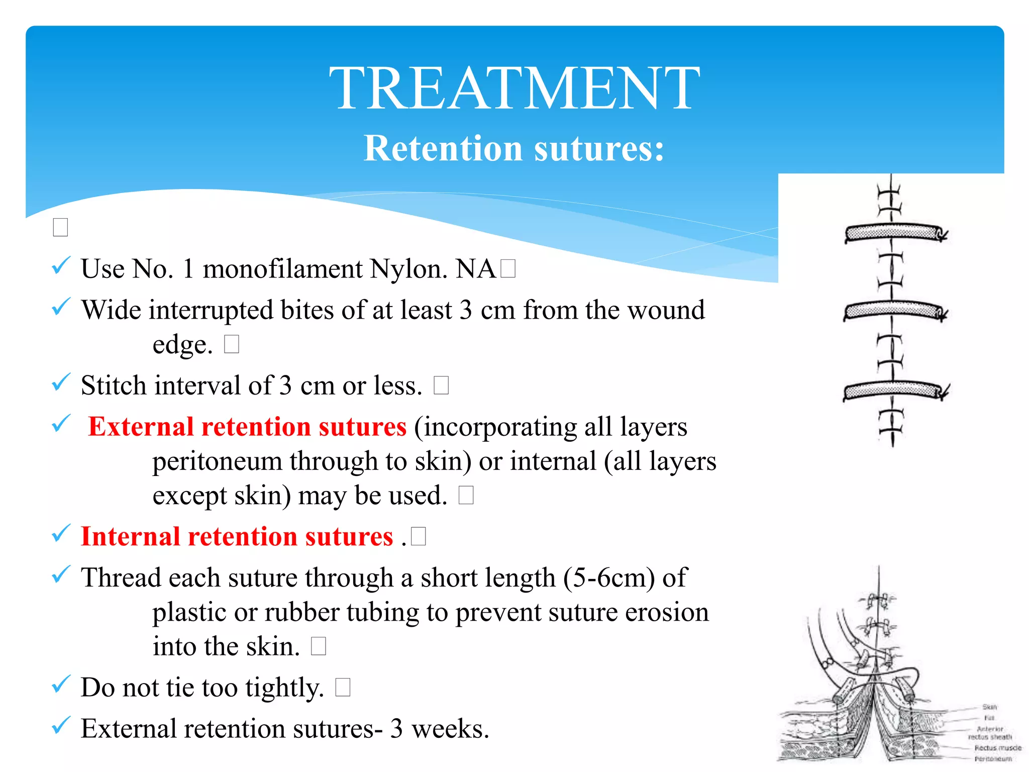 WOUND DEHISCENCE | PPTX