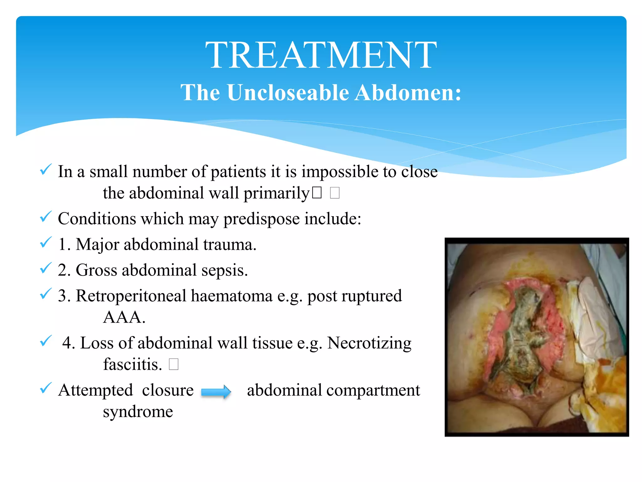 WOUND DEHISCENCE | PPTX