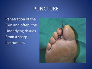 Wound dressing | PPTX