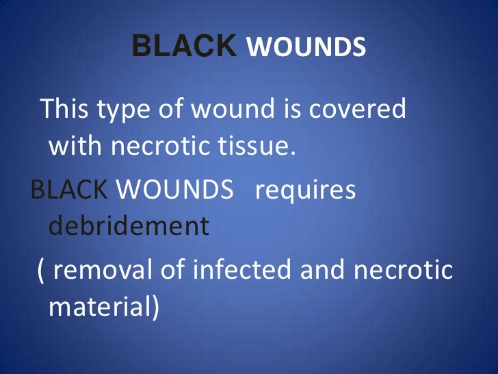 Wound dressing