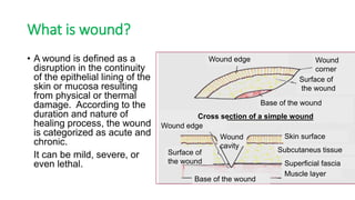 wounddressing-180526060439.pdf
