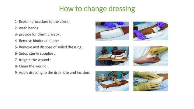 Wound dressing | PPTX