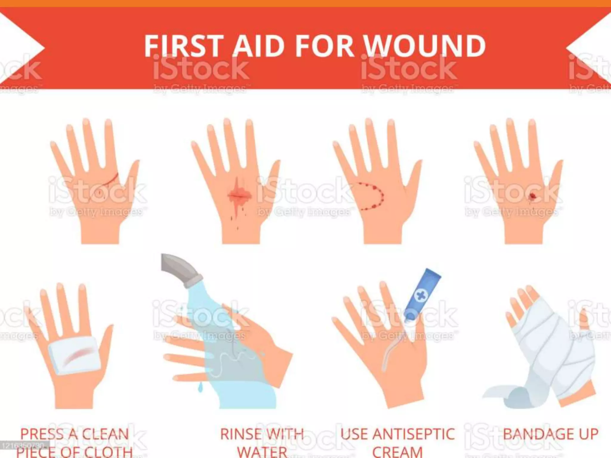 Wound dressing | PPTX