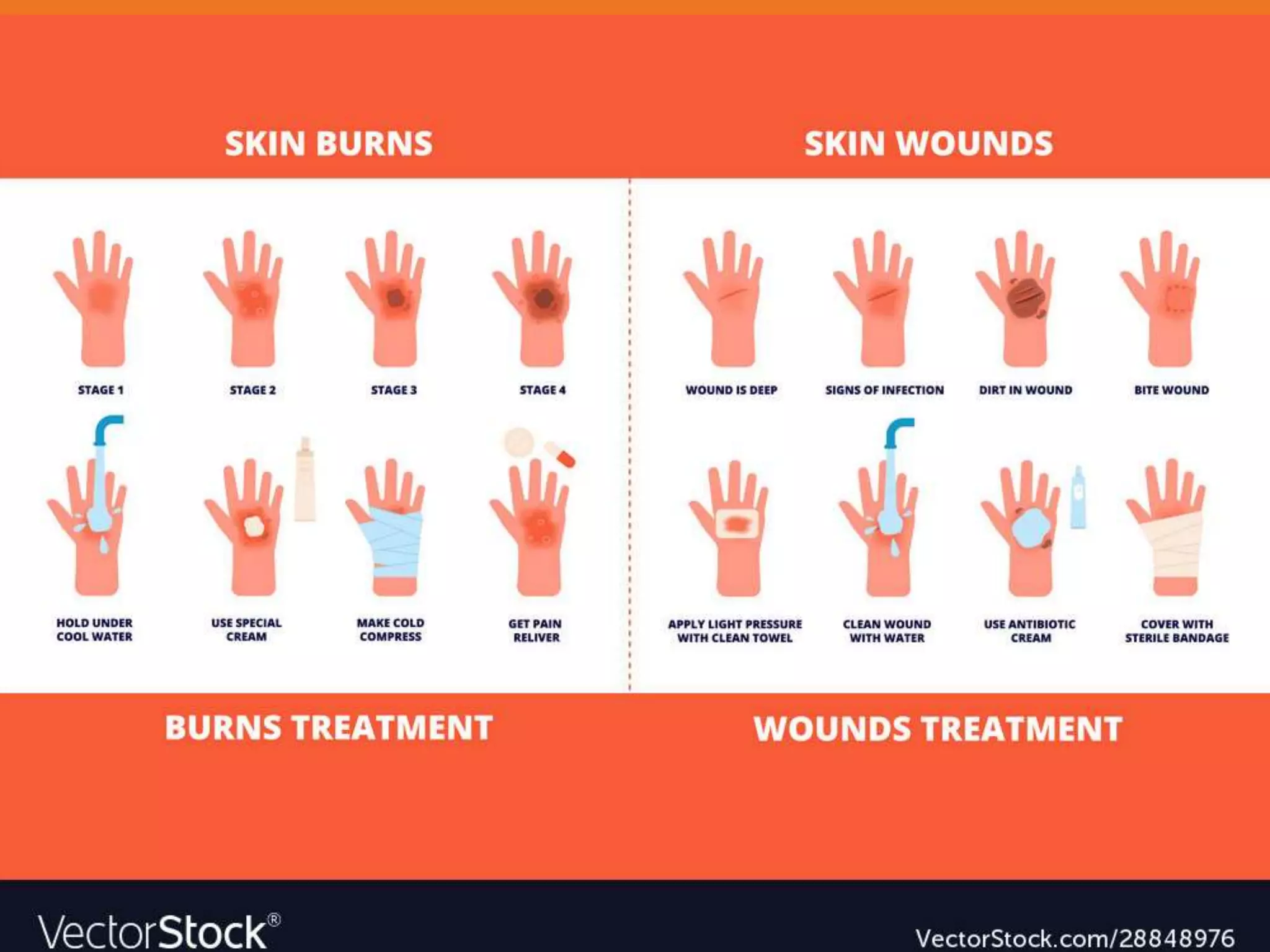Wound dressing | PPTX
