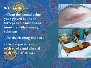 Wound dressing (1).ppt